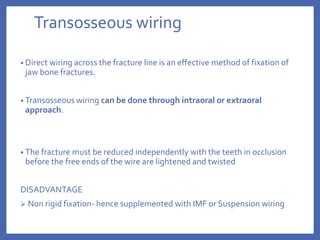 fixation systems in maxillofacial fractures | PPTX