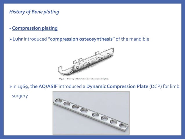 fixation systems in maxillofacial fractures | PPTX
