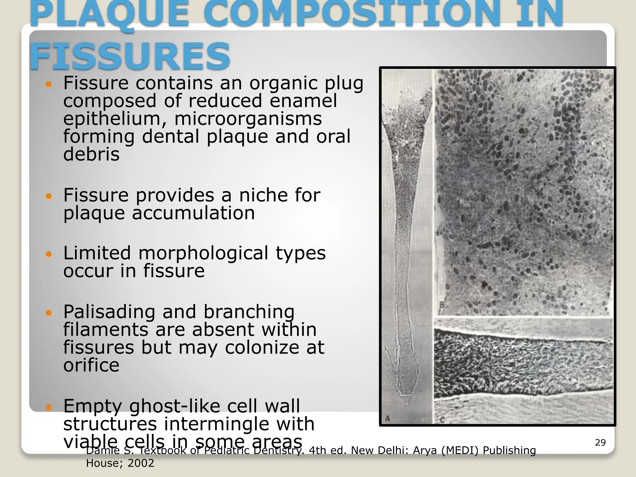 Pit & Fissure Sealant .pptx