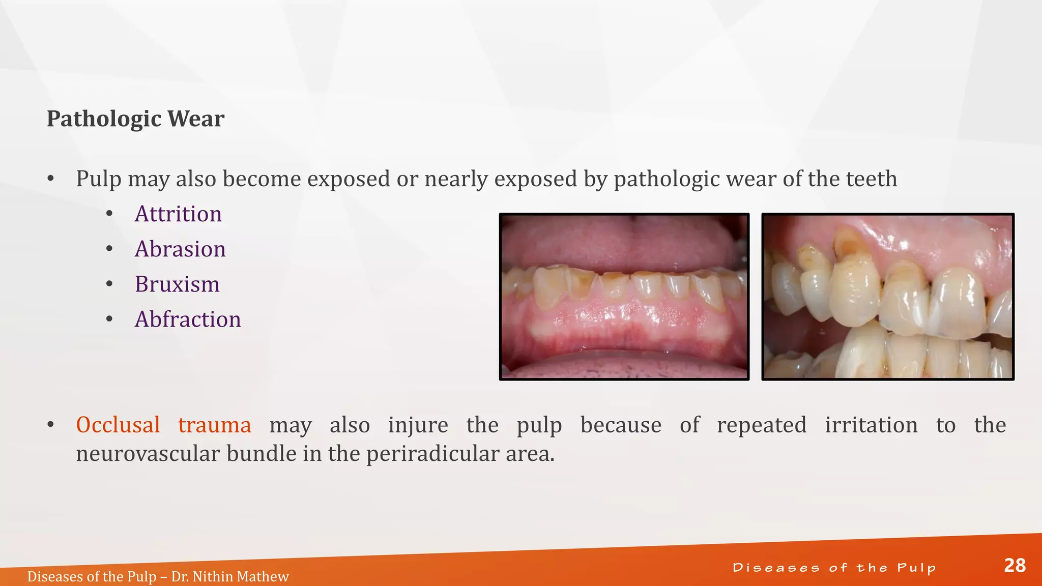 Diseases of the Pulp | PDF