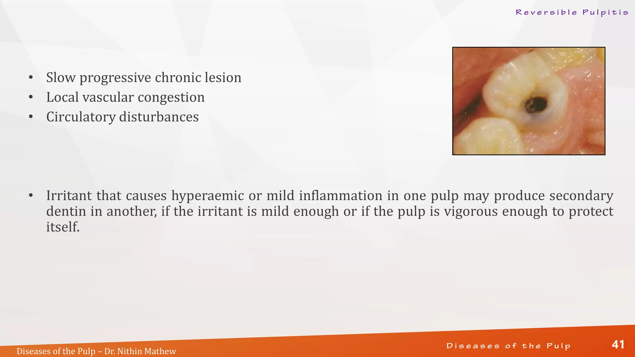 Diseases of the Pulp | PDF