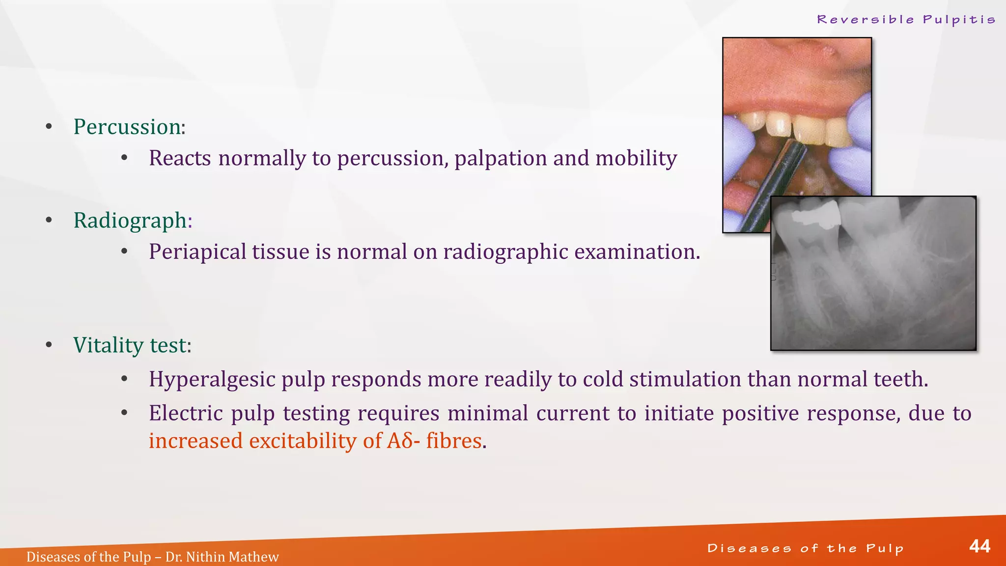 Diseases of the Pulp | PDF