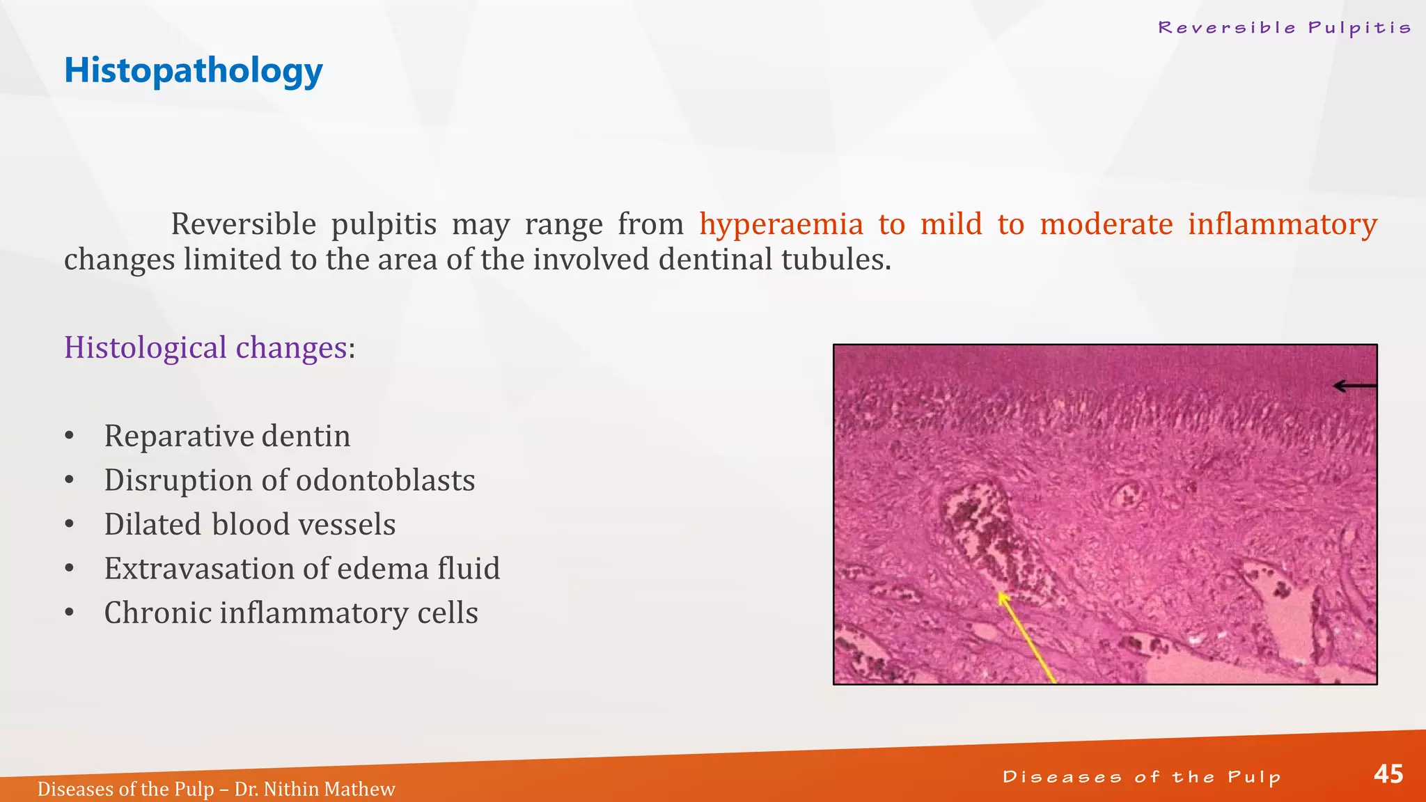 Diseases of the Pulp | PDF