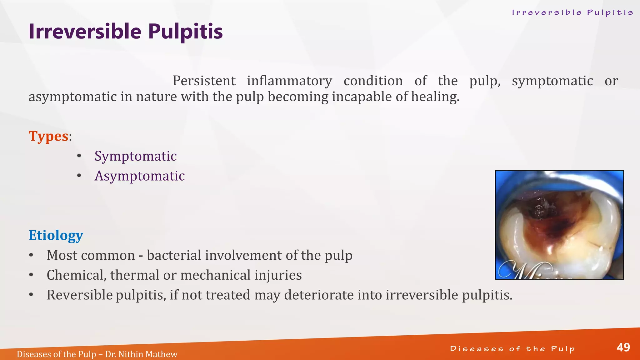 Diseases of the Pulp | PDF
