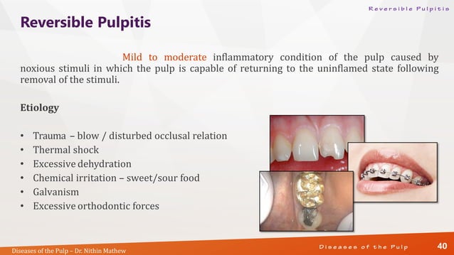 Diseases of the Pulp | PDF