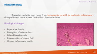 Diseases of the Pulp | PDF