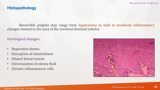 Diseases of the Pulp | PDF
