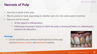Diseases of the Pulp | PDF