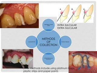 Various Defense mechanism of gingiva.pptx