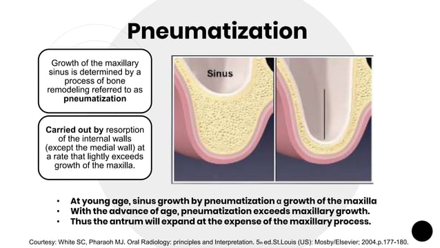 Maxillary sinus imaging | PPTX | Ear, Nose and Throat Conditions ...
