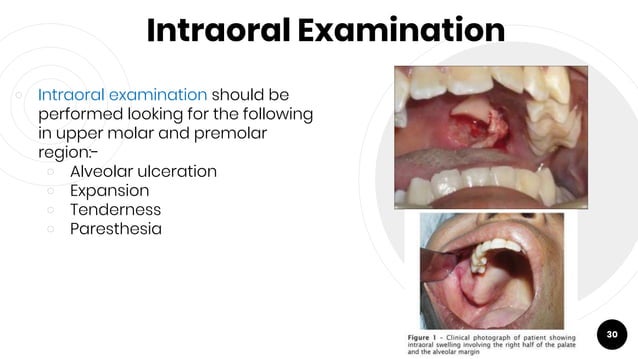Maxillary sinus imaging | PPTX | Ear, Nose and Throat Conditions ...
