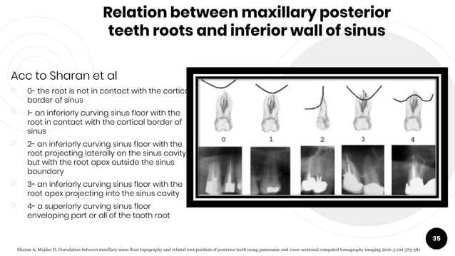 Maxillary sinus imaging | PPTX | Ear, Nose and Throat Conditions ...