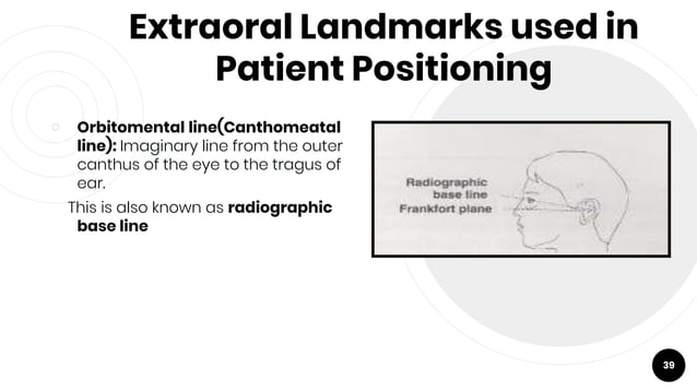 Maxillary sinus imaging | PPTX | Ear, Nose and Throat Conditions ...