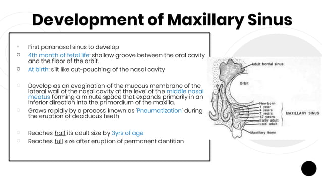 Maxillary sinus imaging | PPTX | Ear, Nose and Throat Conditions ...