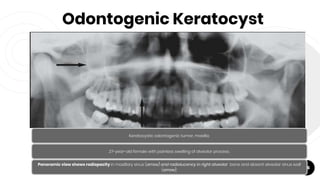 Maxillary sinus imaging | PPTX