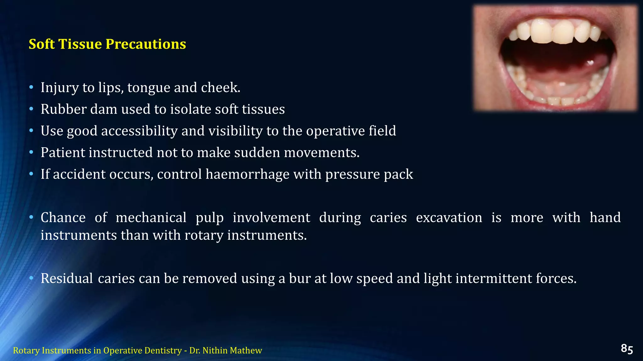 Rotary Instruments in Operative Dentistry | PDF