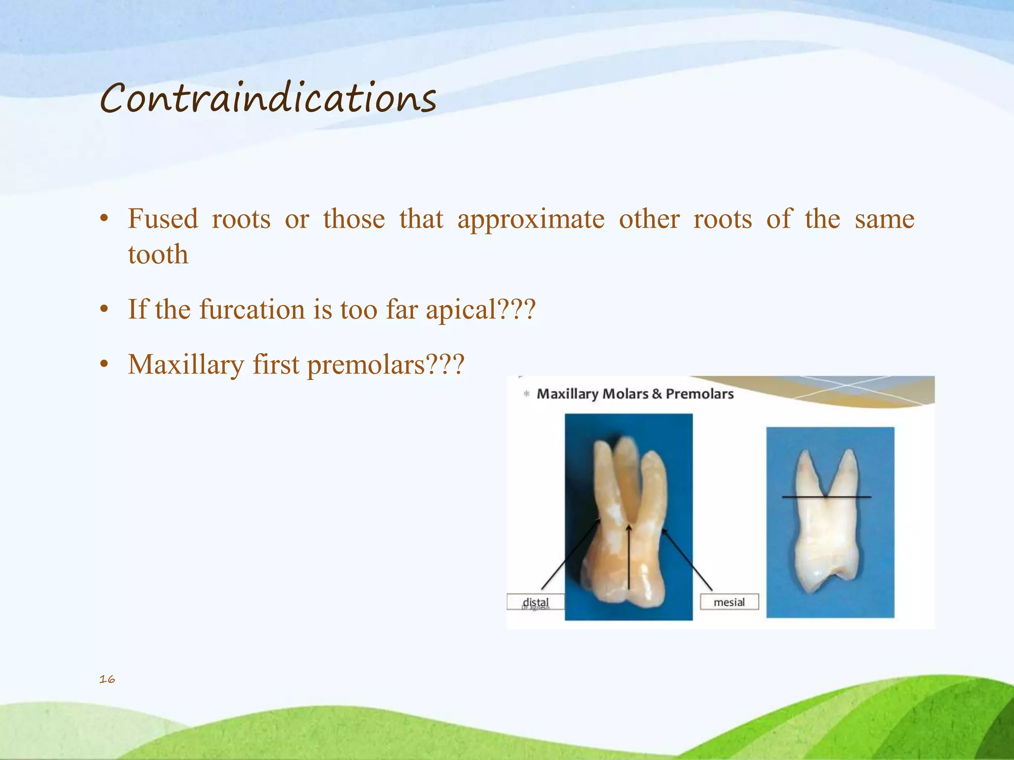 Preparation of periodontally weakened teeth | PPTX