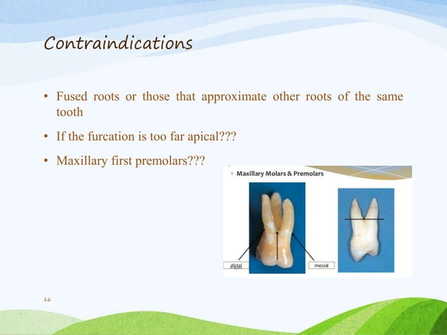 Preparation of periodontally weakened teeth | PPTX | Dental Health ...