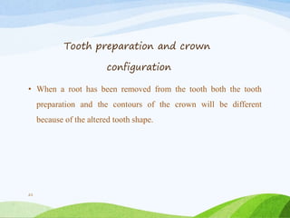 Preparation of periodontally weakened teeth | PPTX