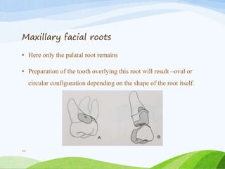 Preparation of periodontally weakened teeth | PPTX