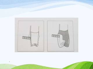 Preparation of periodontally weakened teeth | PPTX