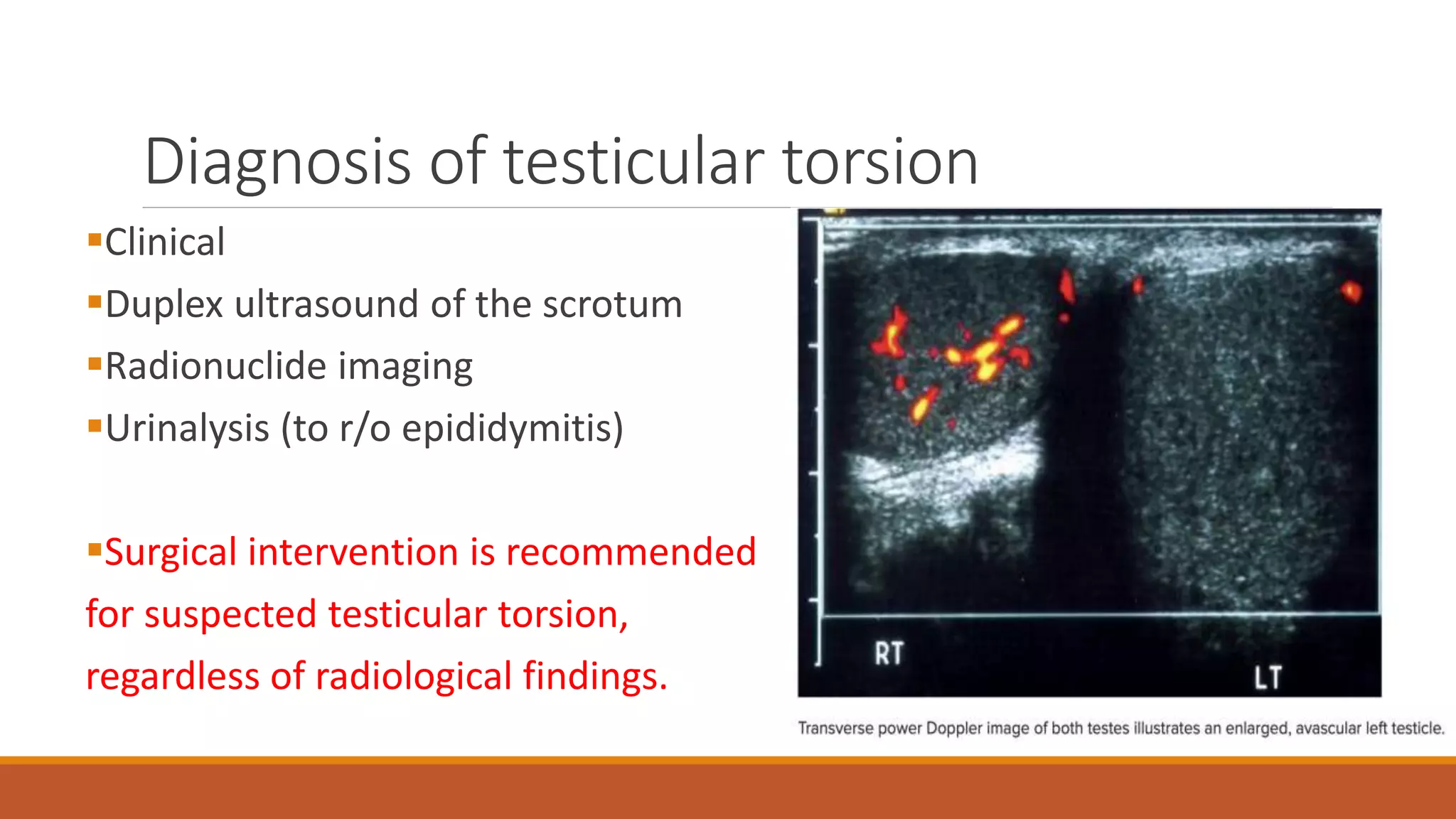Acute Scrotum | PPTX