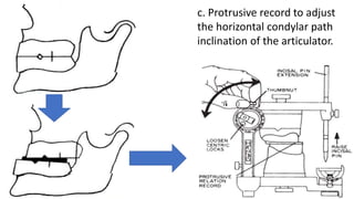 Dental articulators | PPT