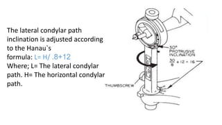 Dental articulators | PPT