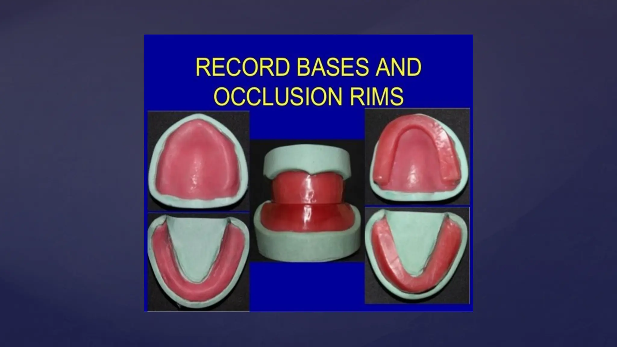 CLINICAL STEPS IN BALANCED OCCLUSION.pptx