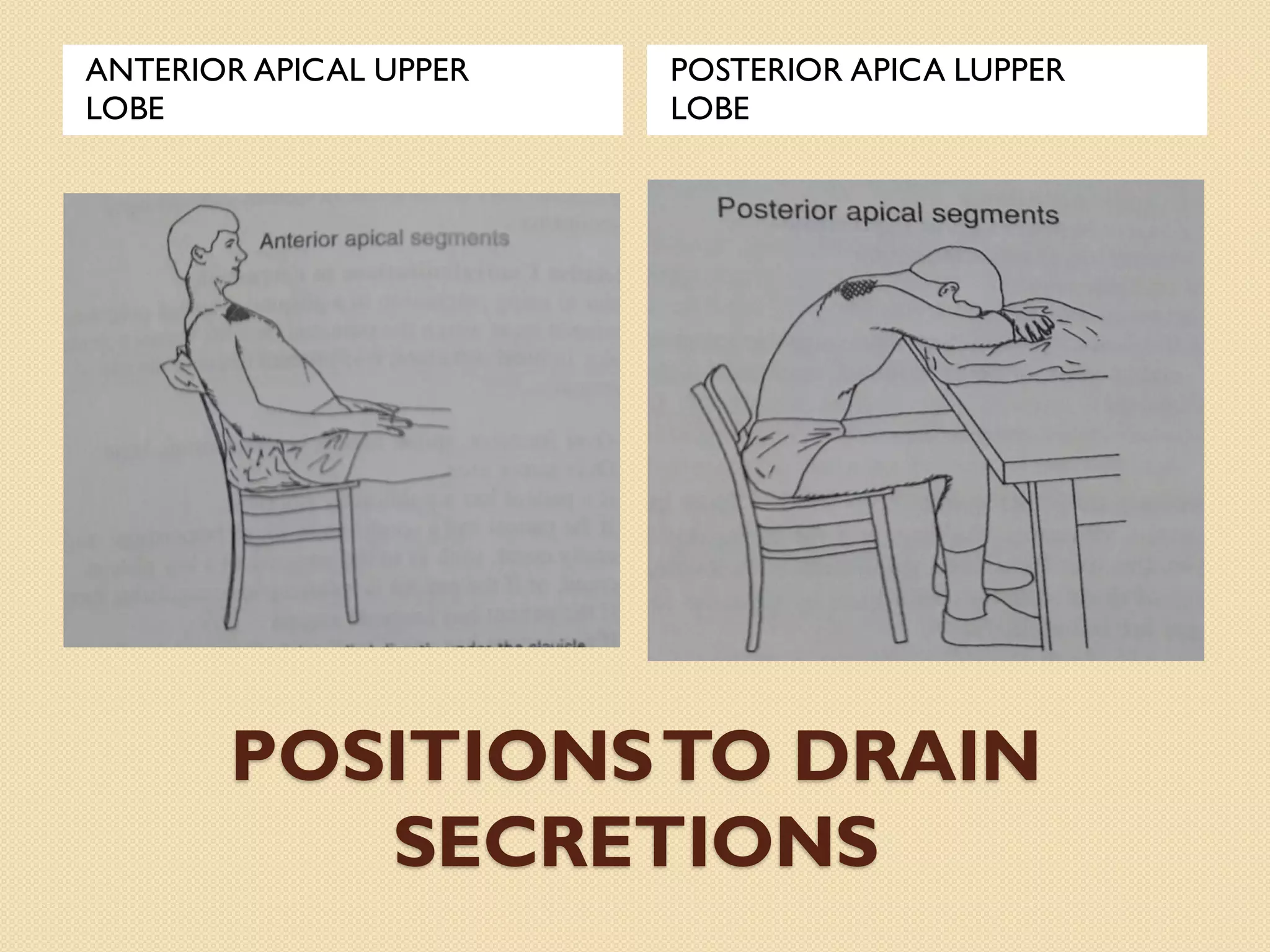 body mechanics and transfer techniques | PDF