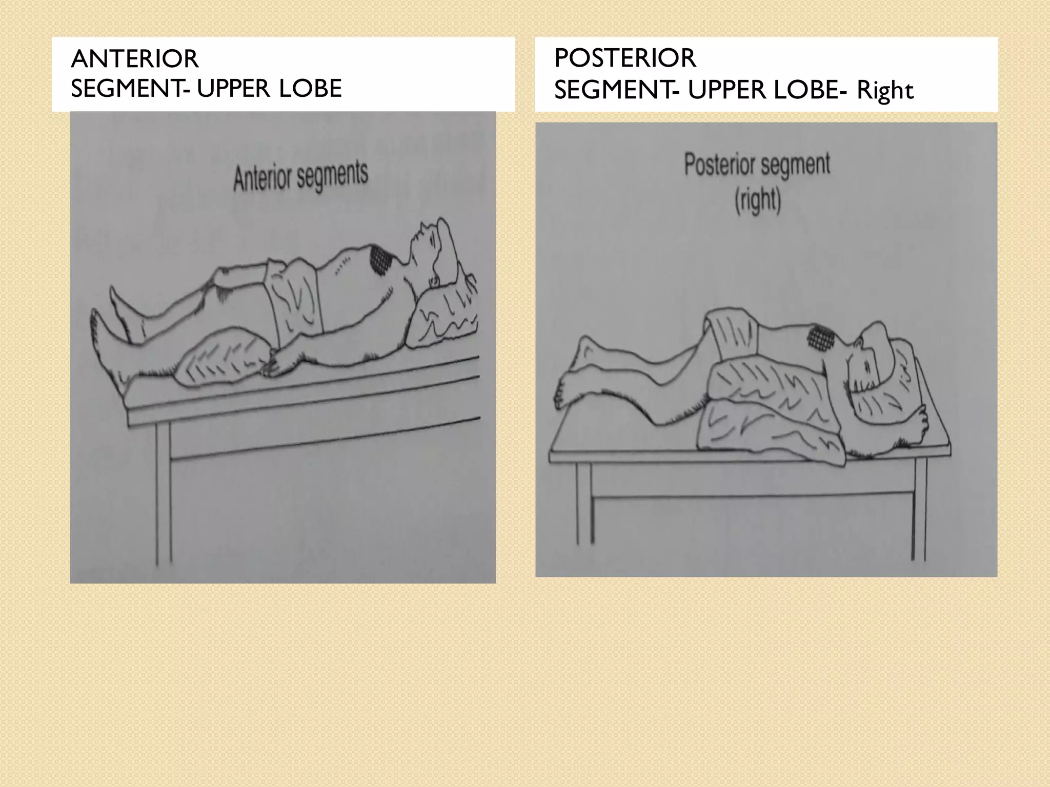 body mechanics and transfer techniques | PDF