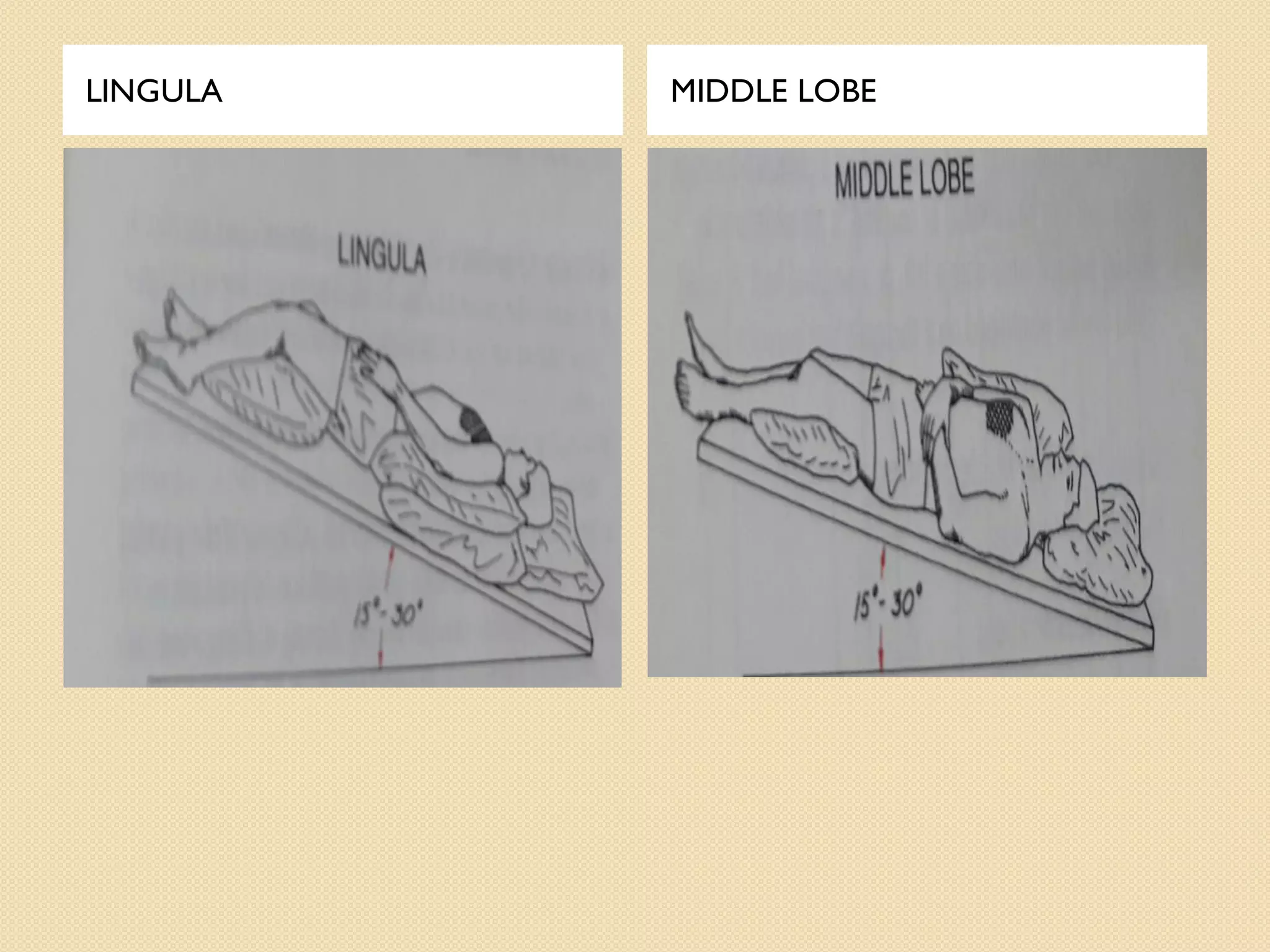 body mechanics and transfer techniques | PDF