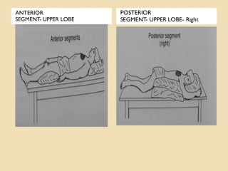 body mechanics and transfer techniques | PDF