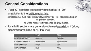 seminar brain anatomy on brain ct .pptx