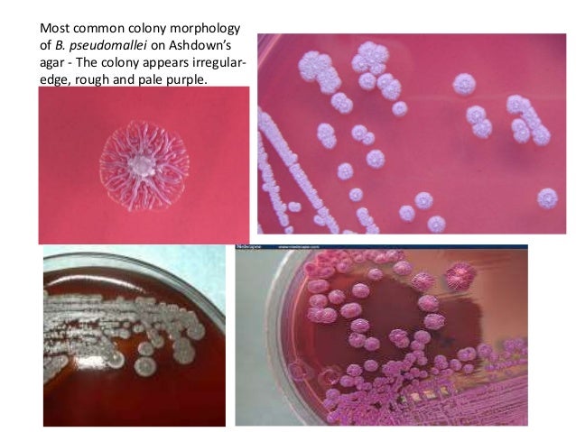 Seminar burkholderia 1