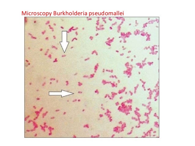 Seminar burkholderia 1