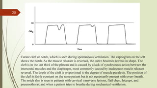 capnography and its types of graphs powerpoint | PPTX