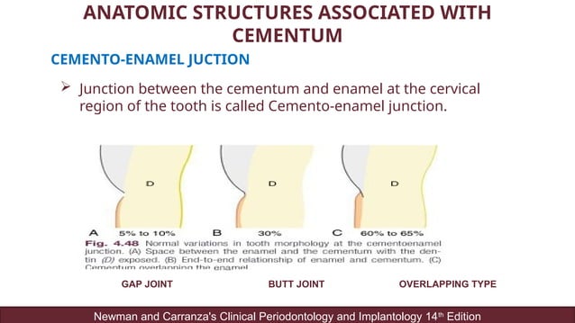 Seminar Cementum (part covering the root surface).pptx
