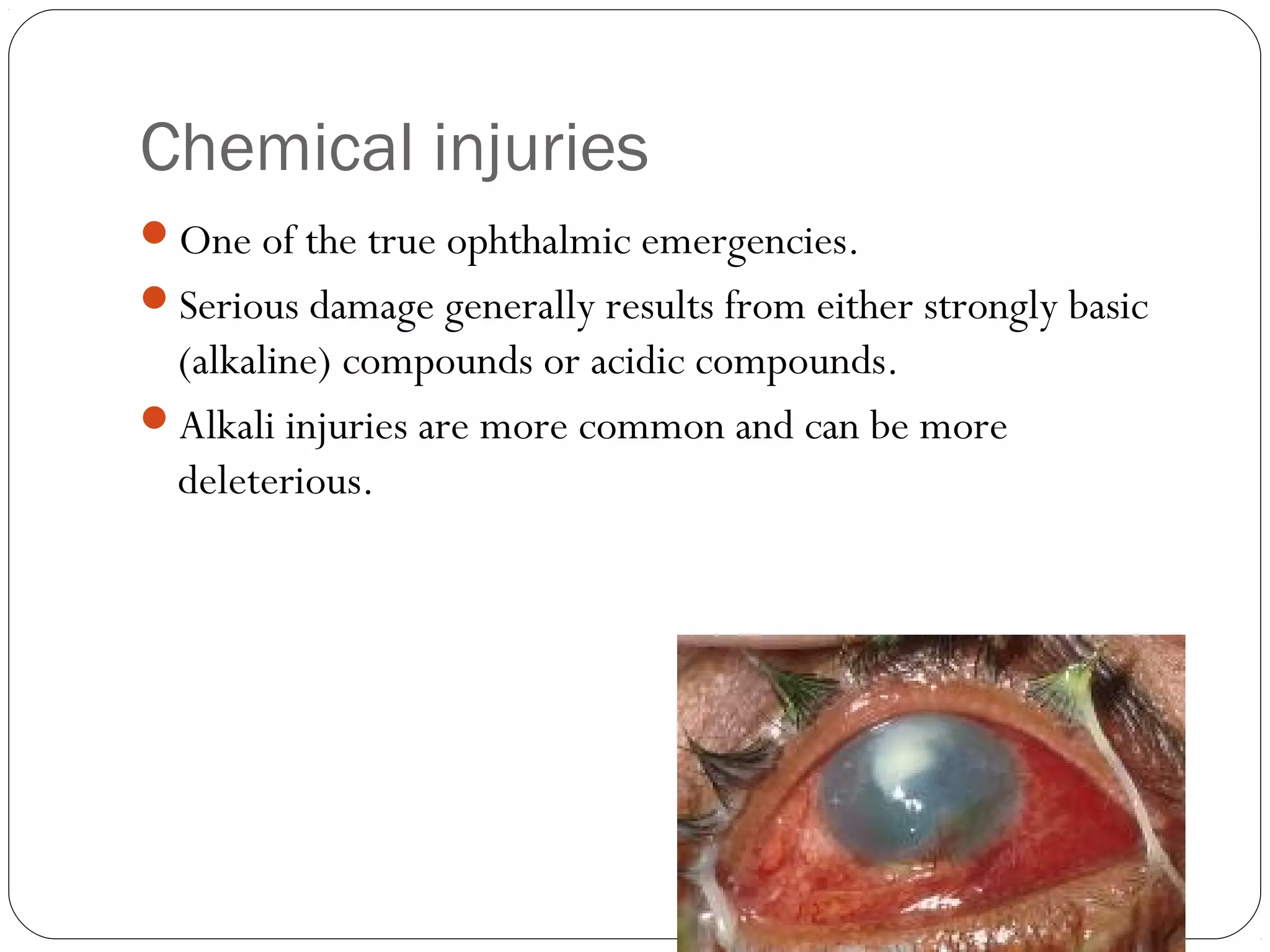 Seminar chemical injuries | PPT