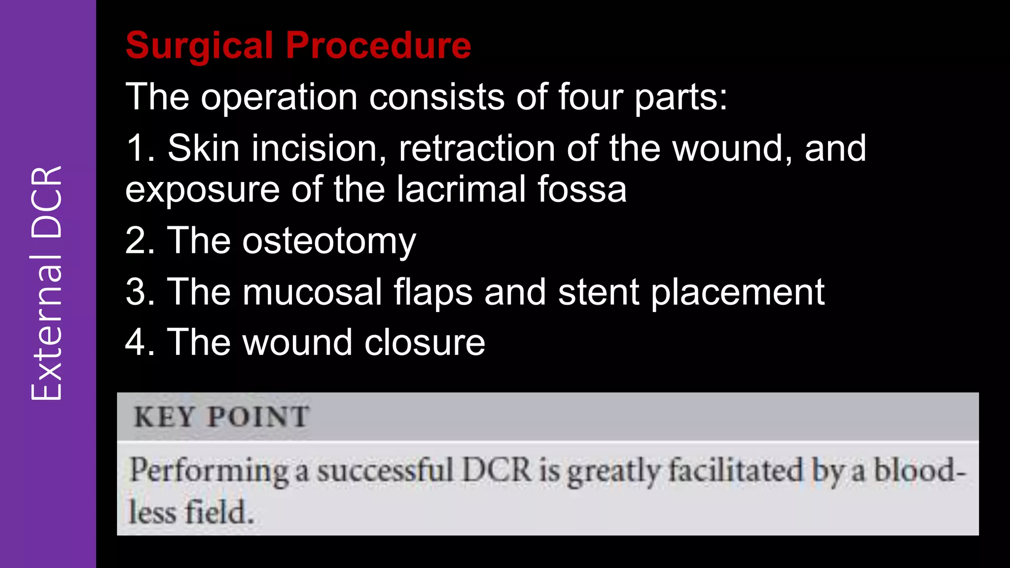 Dacrocystitis: Diagnosis and Management | PPTX