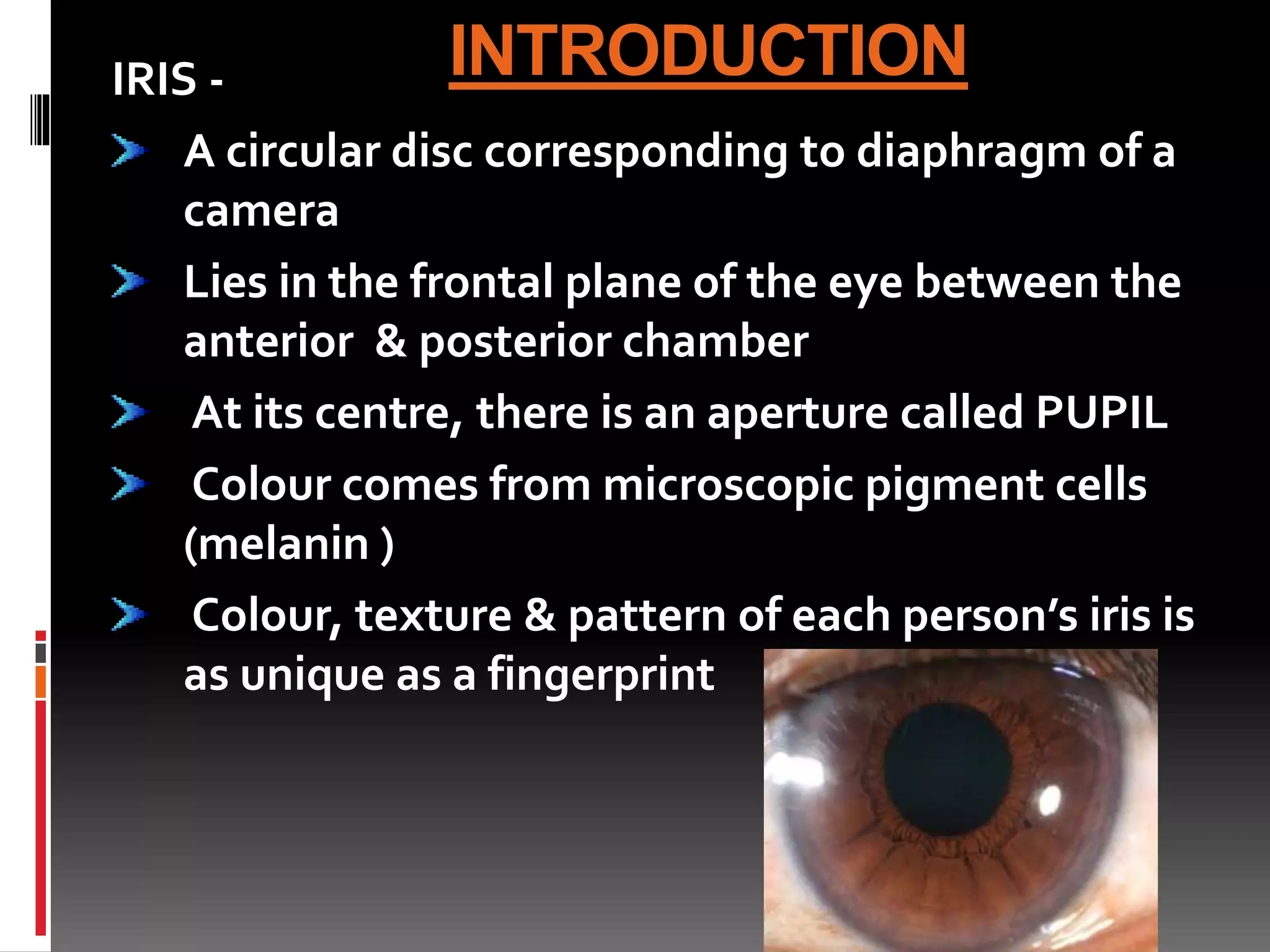 ANATOMY OF IRIS AND ITS CONGENITAL ANOMALIES | PPTX