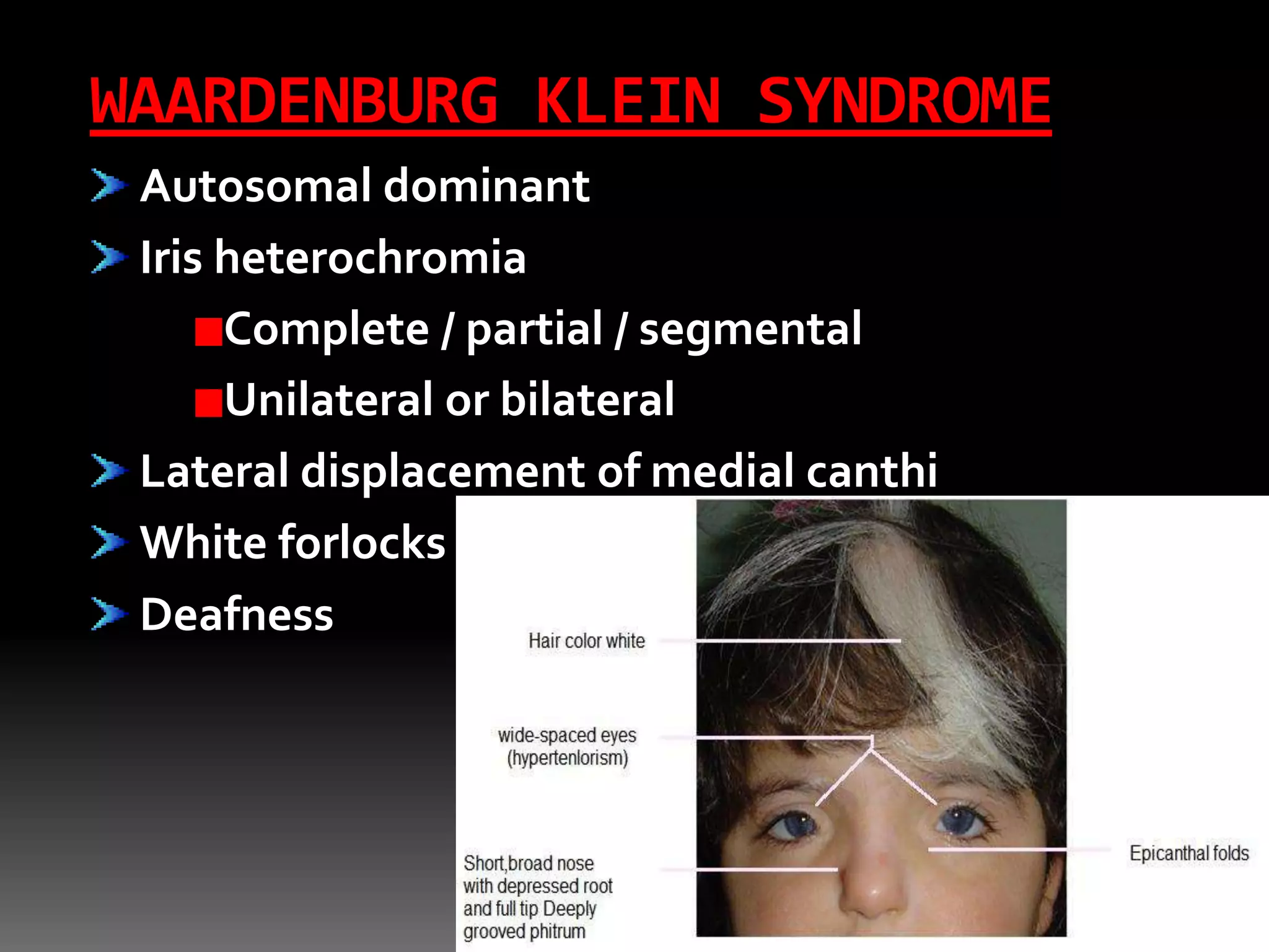 ANATOMY OF IRIS AND ITS CONGENITAL ANOMALIES | PPTX