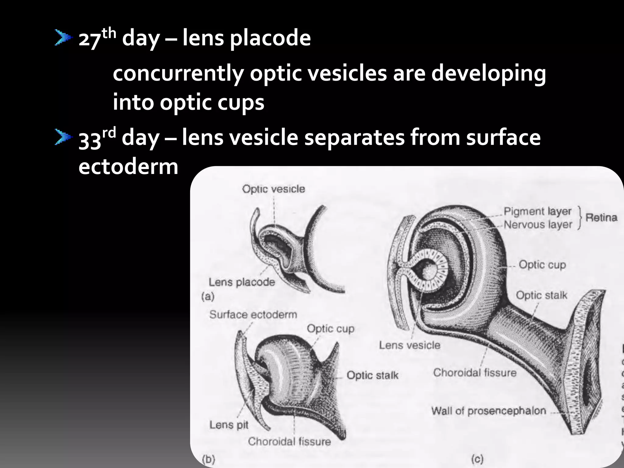 ANATOMY OF IRIS AND ITS CONGENITAL ANOMALIES | PPTX