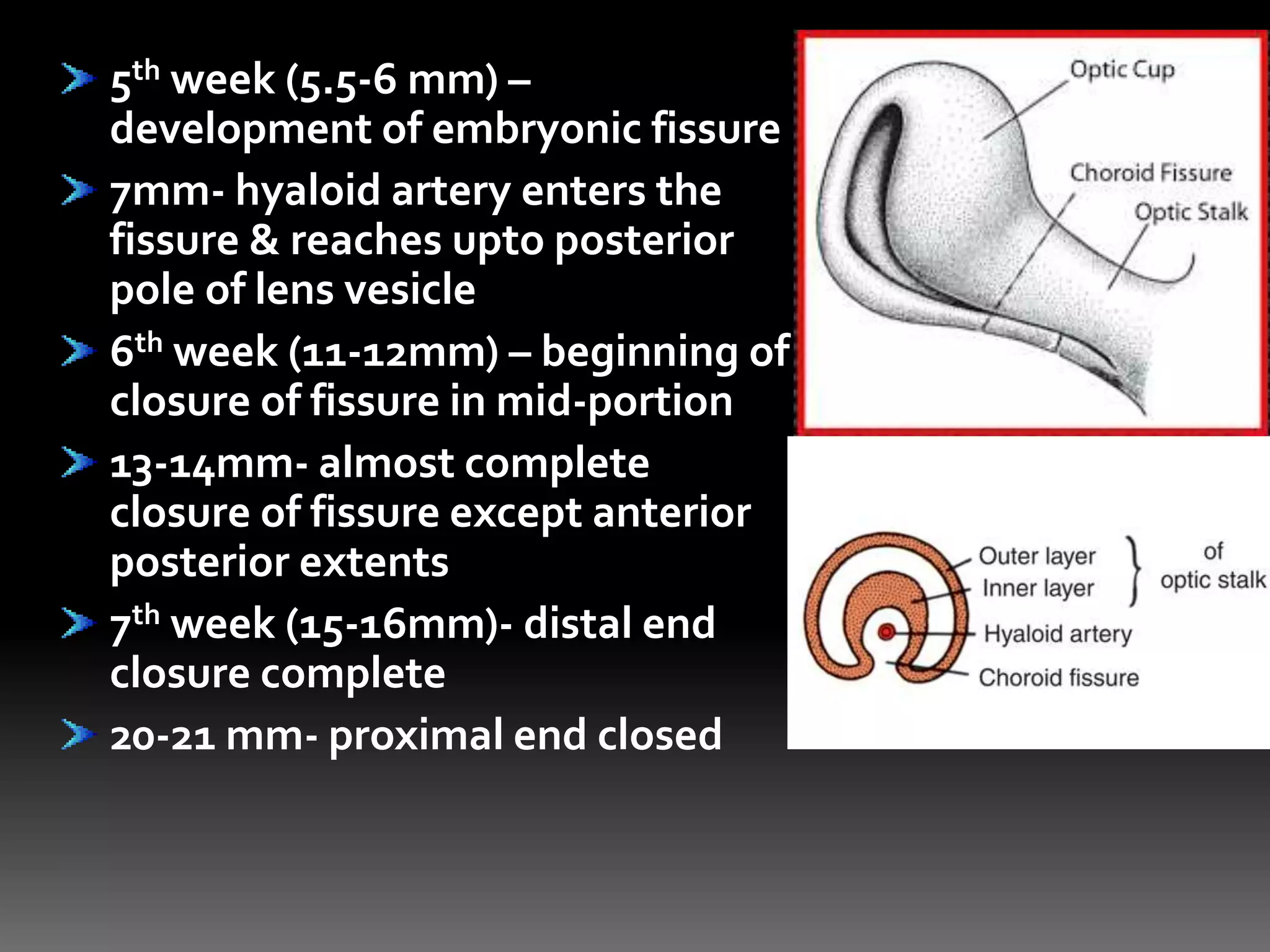 ANATOMY OF IRIS AND ITS CONGENITAL ANOMALIES | PPTX