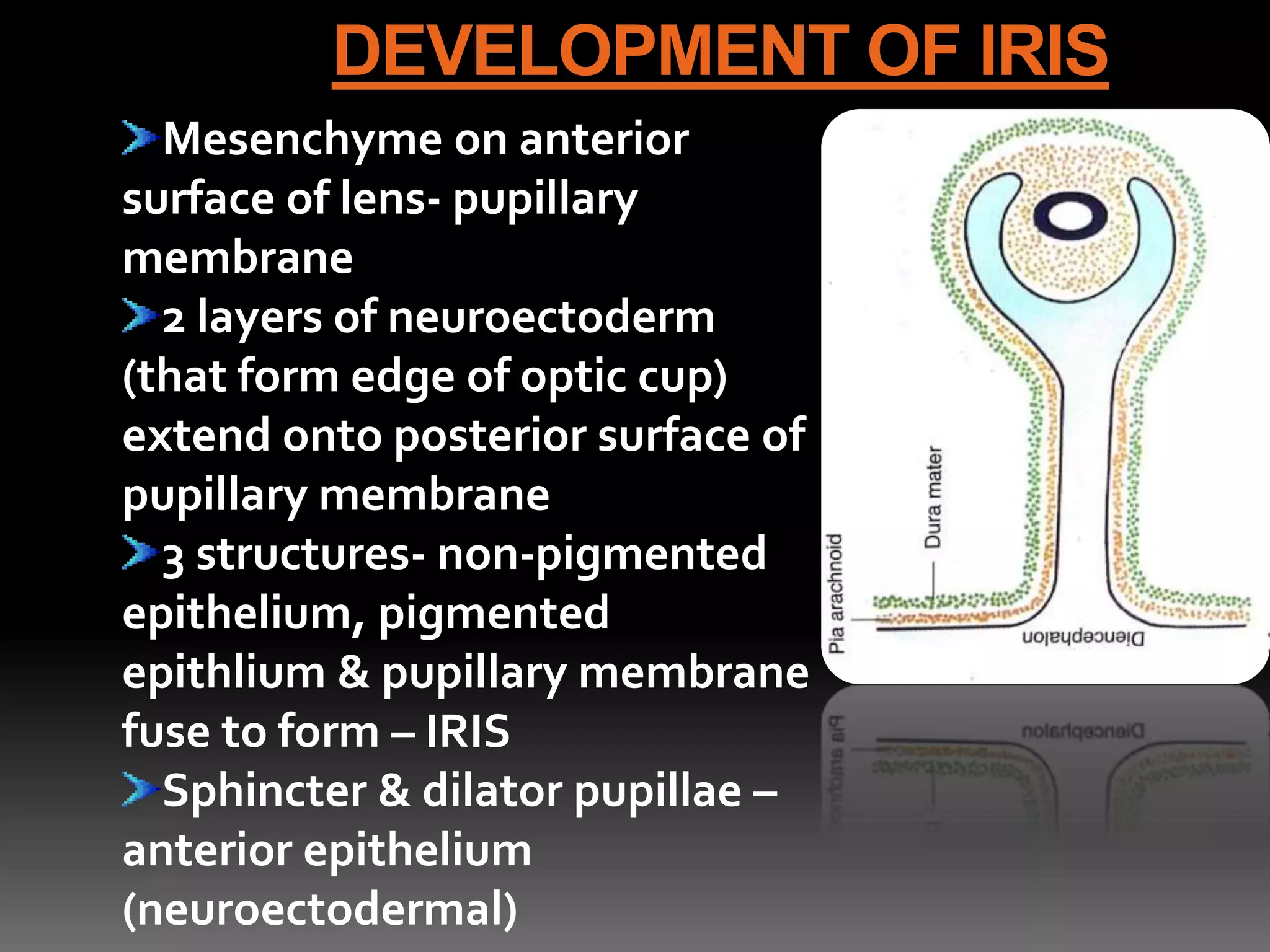 ANATOMY OF IRIS AND ITS CONGENITAL ANOMALIES | PPTX