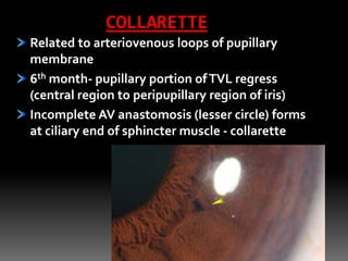 ANATOMY OF IRIS AND ITS CONGENITAL ANOMALIES | PPTX