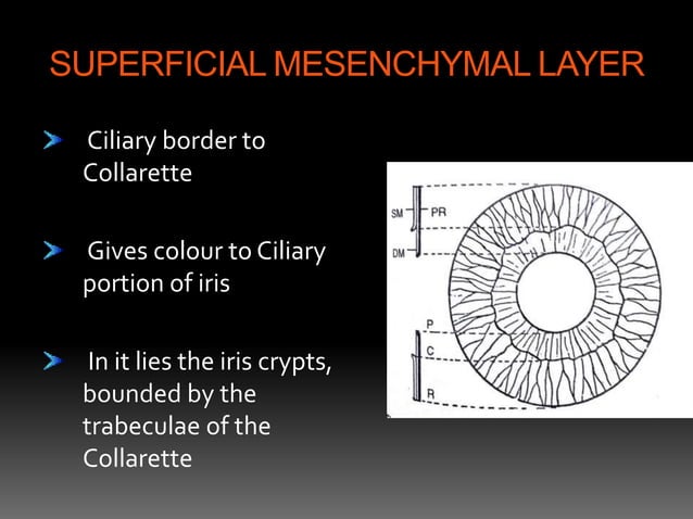 ANATOMY OF IRIS AND ITS CONGENITAL ANOMALIES | PPTX | Eye and Vision ...