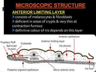 ANATOMY OF IRIS AND ITS CONGENITAL ANOMALIES | PPTX