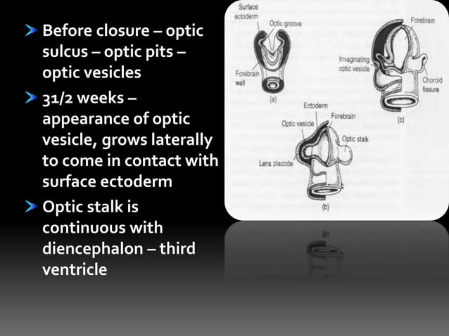 ANATOMY OF IRIS AND ITS CONGENITAL ANOMALIES | PPTX | Eye and Vision ...