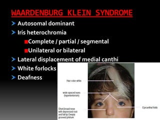 ANATOMY OF IRIS AND ITS CONGENITAL ANOMALIES | PPTX
